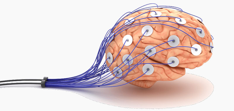 Migraine, Anxiety and ADHD Treatment | St Louis Neurotherapy Institute Migraine, Anxiety and ADHD Treatment | St Louis Neurotherapy Institute
